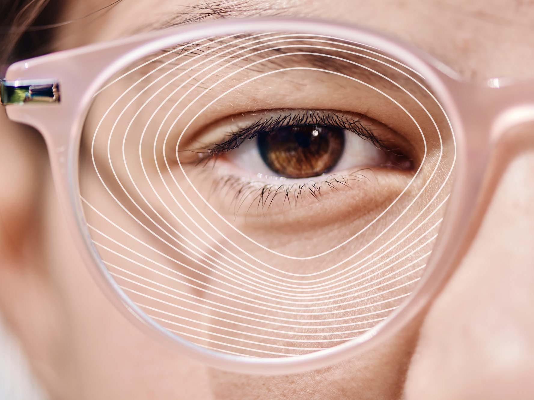 ZEISS Myopia management lenses